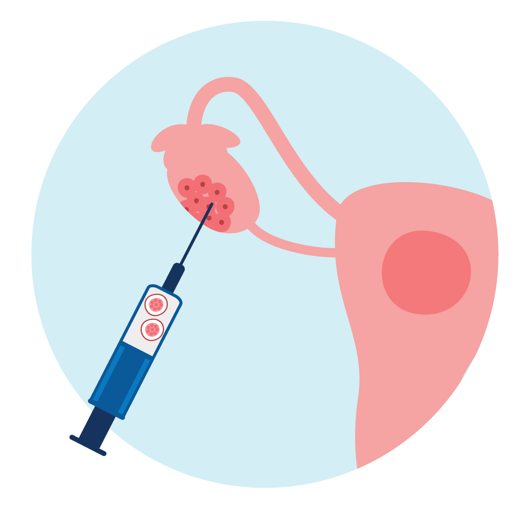 Ivf For Gay Couples And Individuals In New York Lgbtqia Fertility In Ny